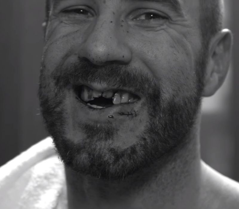5 wrestlers who have had their teeth knocked out